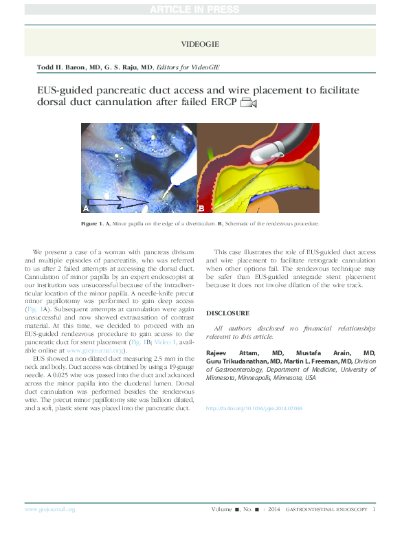 (PDF) EUS-guided pancreatic duct access and wire placement to ...