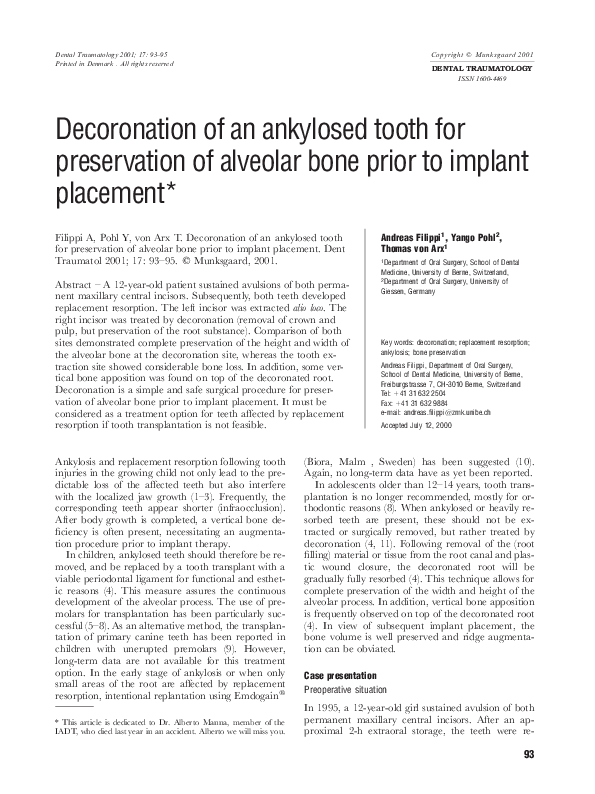 (PDF) Decoronation of an ankylosed tooth for preservation of alveolar ...