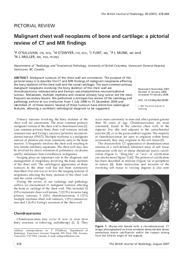 (PDF) Malignant chest wall neoplasms of bone and cartilage: a pictorial ...