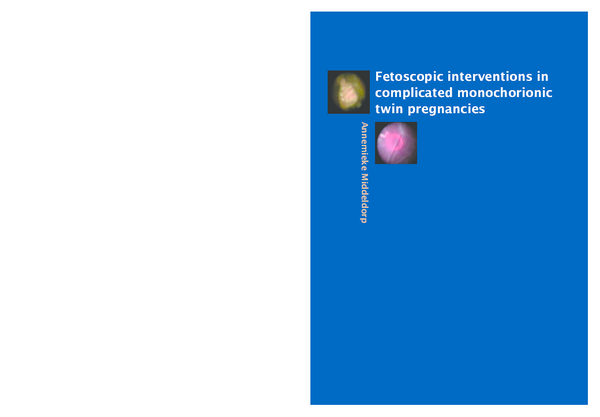 (PDF) Fetoscopic Laser Surgery in 100 Pregnancies with Severe Twin-to ...