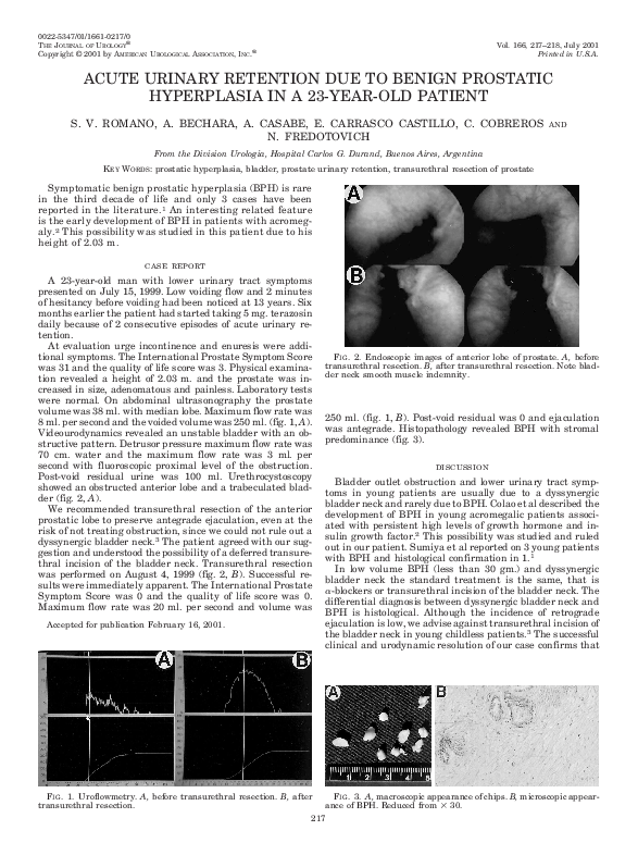 (PDF) ACUTE URINARY RETENTION DUE TO BENIGN PROSTATIC HYPERPLASIA IN A ...