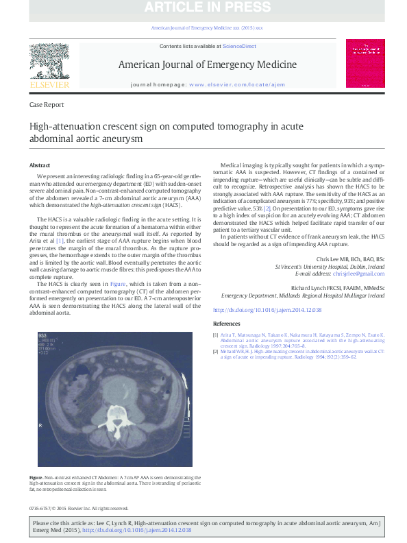(PDF) High Attenuation Crescent Sign (HACS) on CT in Acute Abdominal ...
