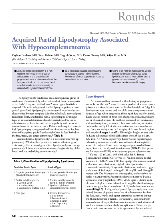 (PDF) Acquired Partial Lipodystrophy Associated With Hypocomplementemia