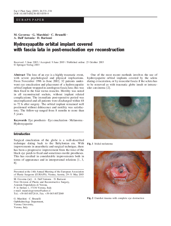 (PDF) Hydroxyapatite Orbital Implants with Fascia Lata in Eye ...