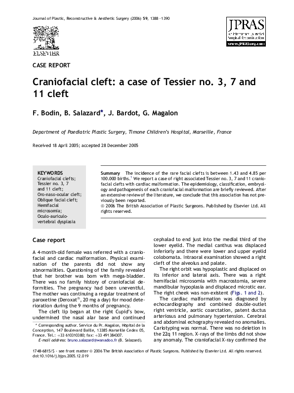 (PDF) Craniofacial cleft: a case of Tessier no. 3, 7 and 11 cleft