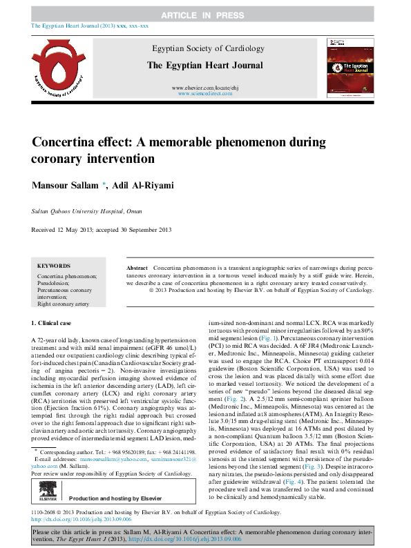 (PDF) Concertina effect: A memorable phenomenon during coronary ...