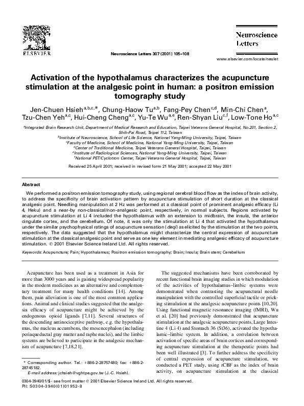 (PDF) Activation of the hypothalamus characterizes the acupuncture ...
