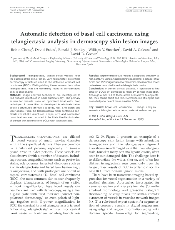 (PDF) Automatic detection of basal cell carcinoma using telangiectasia analysis in dermoscopy ...