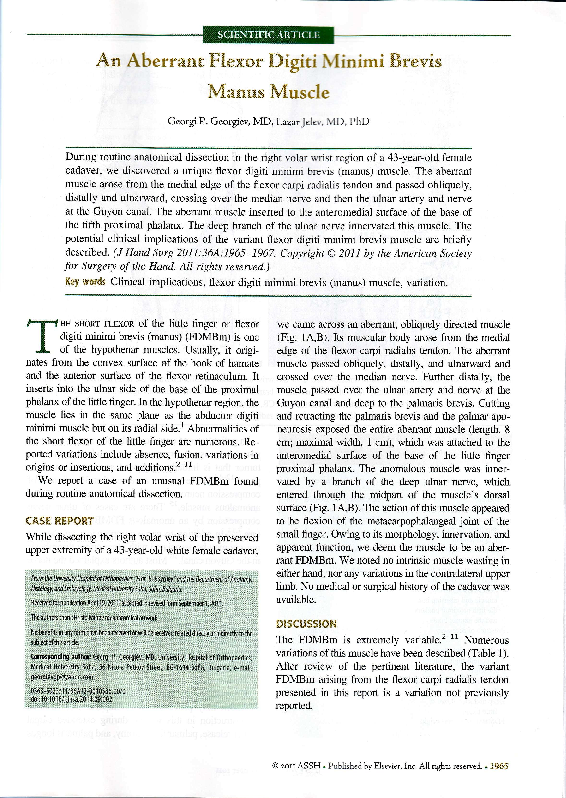 (PDF) An aberrant flexor digiti minimi brevis manus muscle