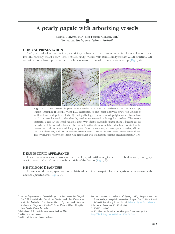 (PDF) A pearly papule with arborizing vessels