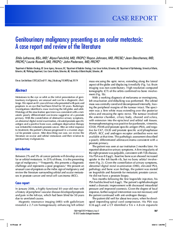 (PDF) Genitourinary malignancy presenting as an ocular metastasis: A ...