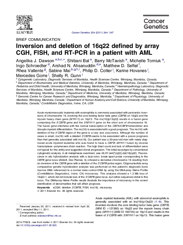 (PDF) Inversion and deletion of 16q22 defined by array CGH, FISH, and ...