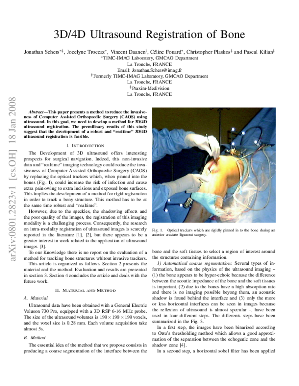 (PDF) P6D-1 3D/4D Ultrasound Registration of Bone