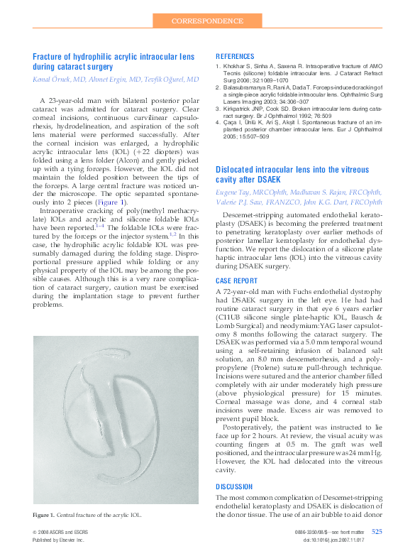 (PDF) Dislocated intraocular lens into the vitreous cavity after DSAEK ...