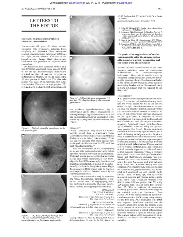 (PDF) Delayed suprachoroidal haemorrhage following trabeculectomy bleb ...