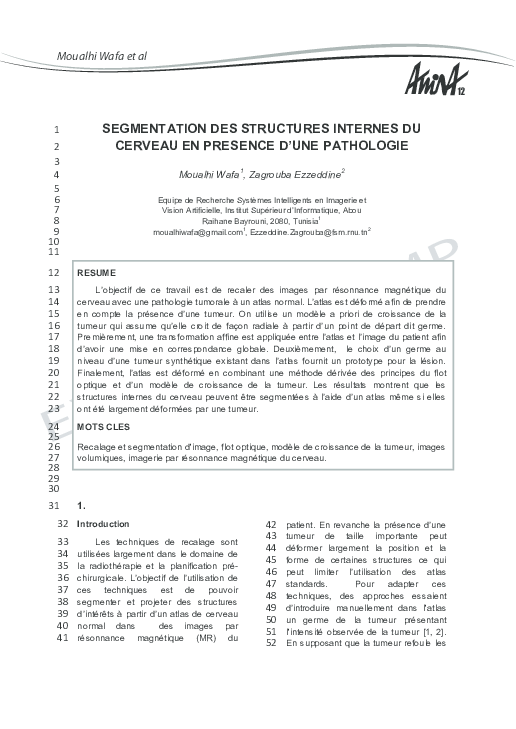 (PDF) Segmentation des structures internes du cerveau en présence d'une pathologie
