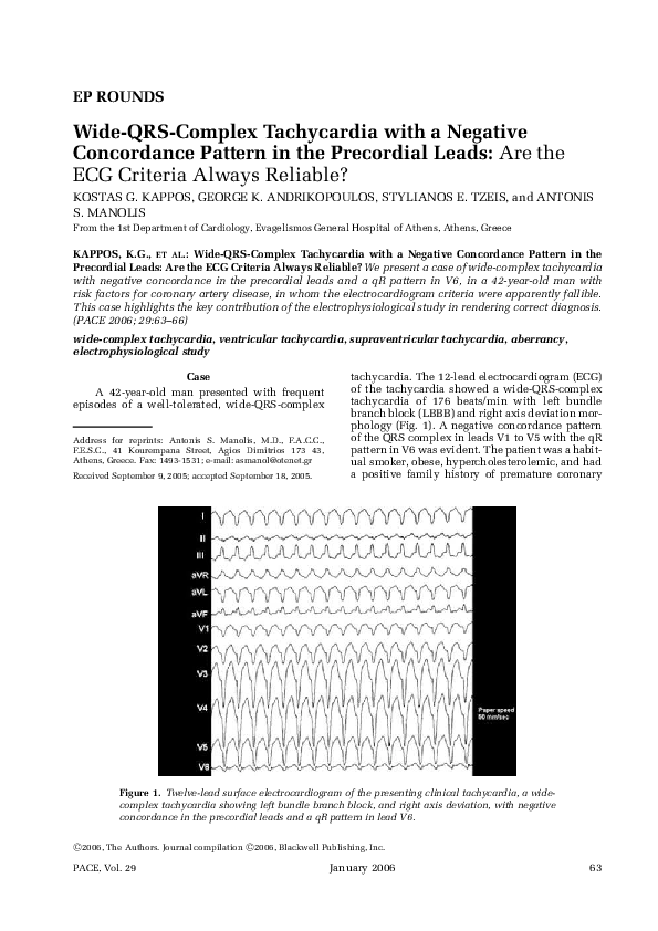 (PDF) Wide-QRS-Complex Tachycardia with a Negative Concordance Pattern ...