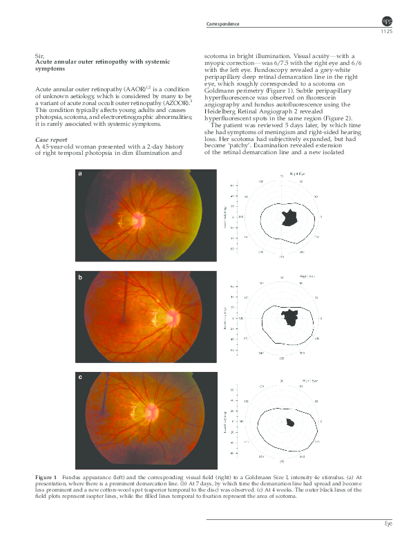 (PDF) Acute annular outer retinopathy with systemic symptoms
