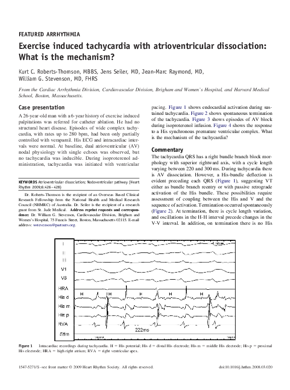 (PDF) Exercise induced tachycardia with atrioventricular dissociation ...