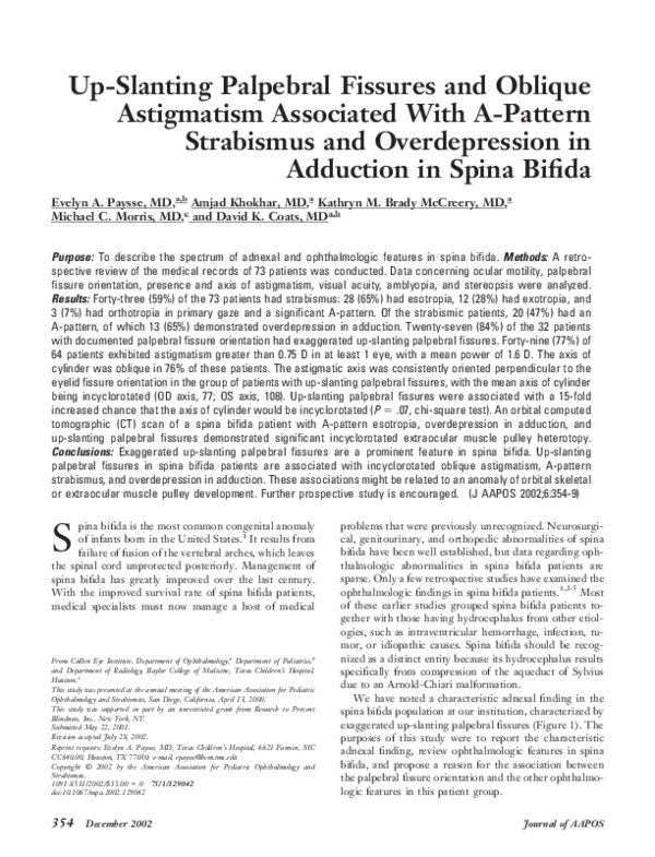 (PDF) Up-slanting palpebral fissures and oblique astigmatism associated ...