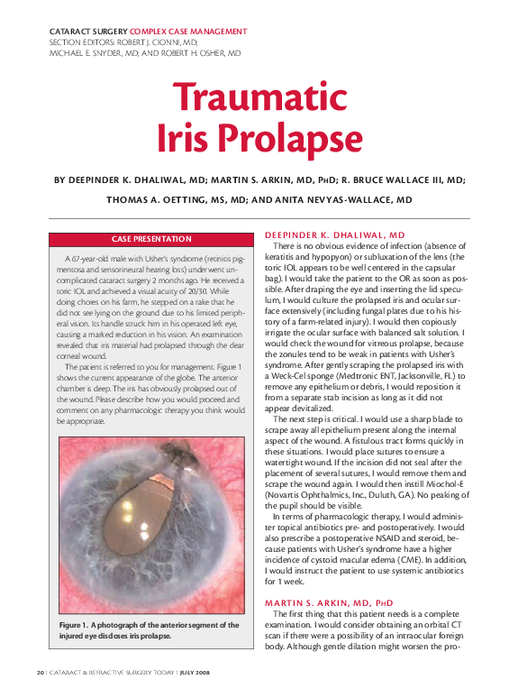 (PDF) Traumatic Iris Prolapse | Robert Cionni - Academia.edu