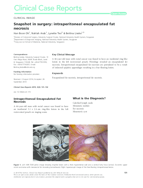 (PDF) Snapshot in surgery: intraperitoneal encapsulated fat necrosis
