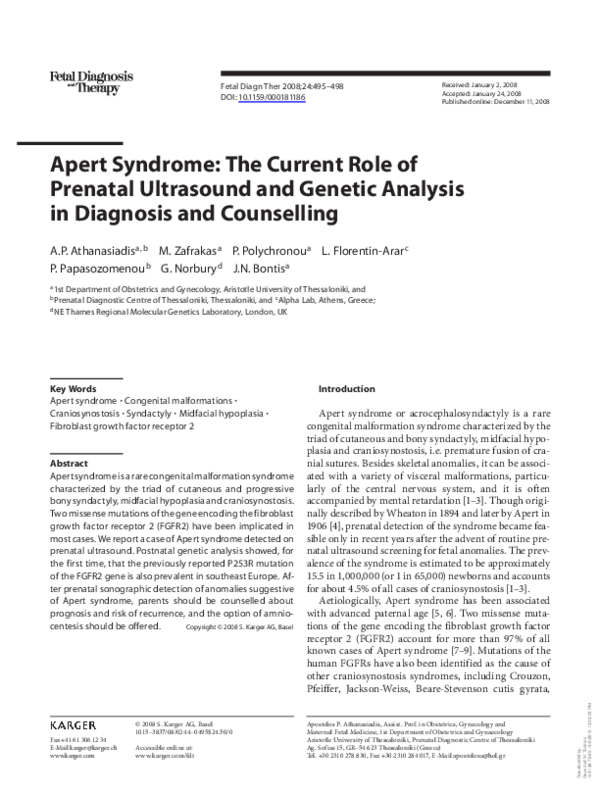 (PDF) Apert’s Syndrome: rare variant of a common anomaly (Craniosynostosis) | Soodhana Dhanya ...