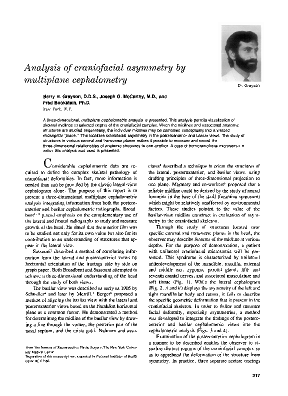 (PDF) Analysis of craniofacial asymmetry by multiplane cephalometry