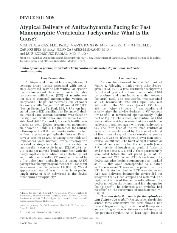 (PDF) Atypical Delivery of Antitachycardia Pacing for Fast Monomorphic ...