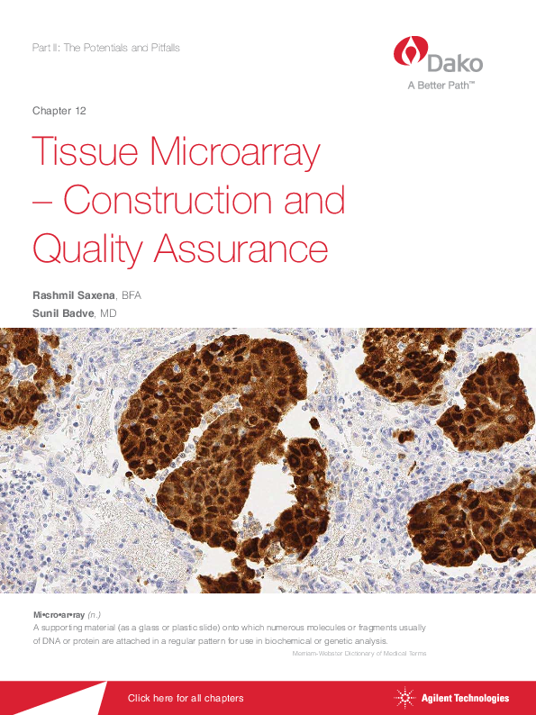 Microarray – Construction and Quality Assurance