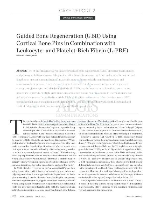(PDF) Guided bone regeneration (GBR) using cortical bone pins in ...