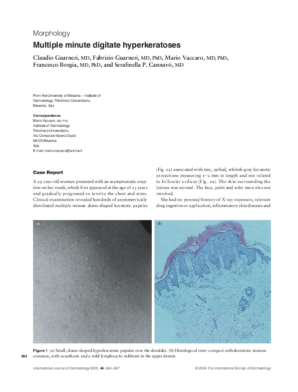 (PDF) Finger pebbles in a diabetic patient: Huntley's papules