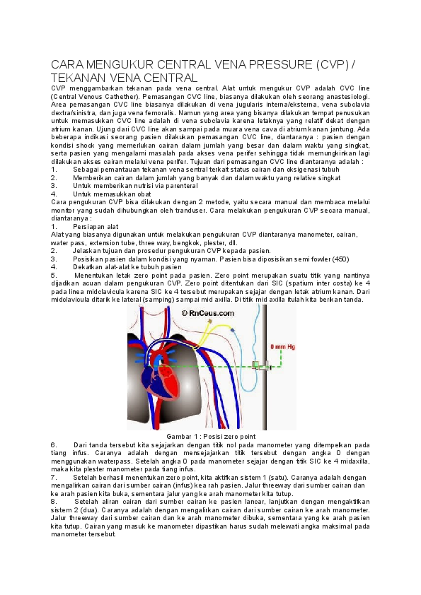 (DOC) CARA MENGUKUR CENTRAL VENA PRESSURE2