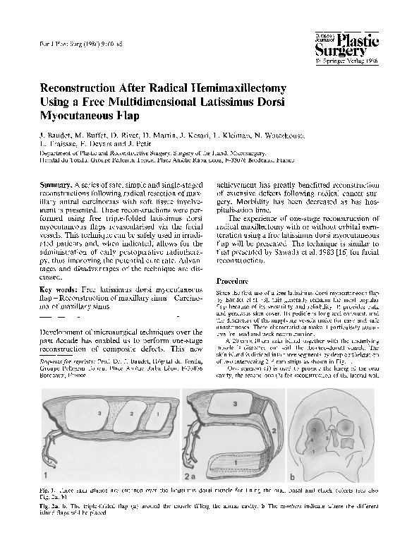 (PDF) Reconstruction after radical hemimaxillectomy using a free ...
