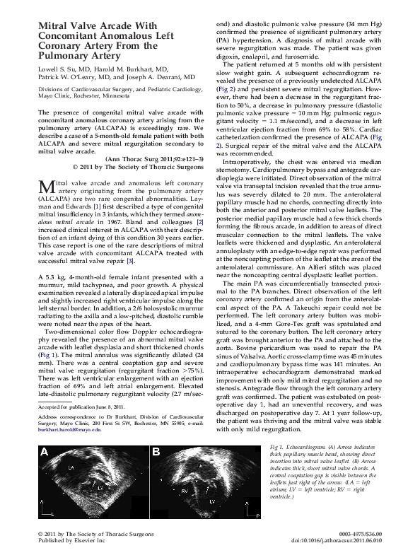 (PDF) Mitral Valve Arcade With Concomitant Anomalous Left Coronary ...
