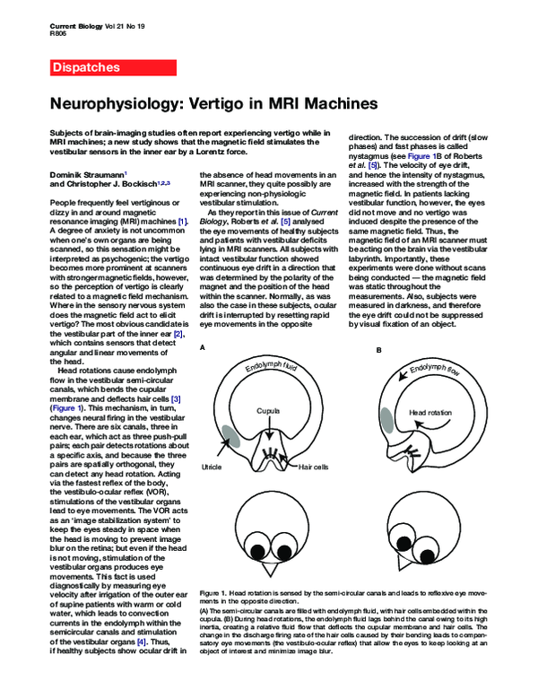 (PDF) Neurophysiology: Vertigo in MRI Machines