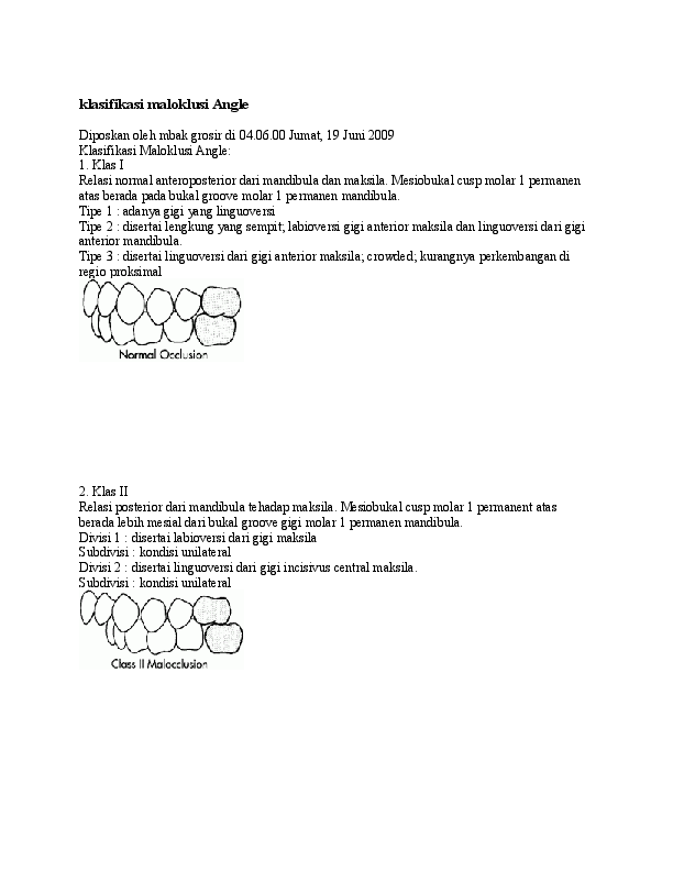 (DOC) Klasifikasi maloklusi Angle