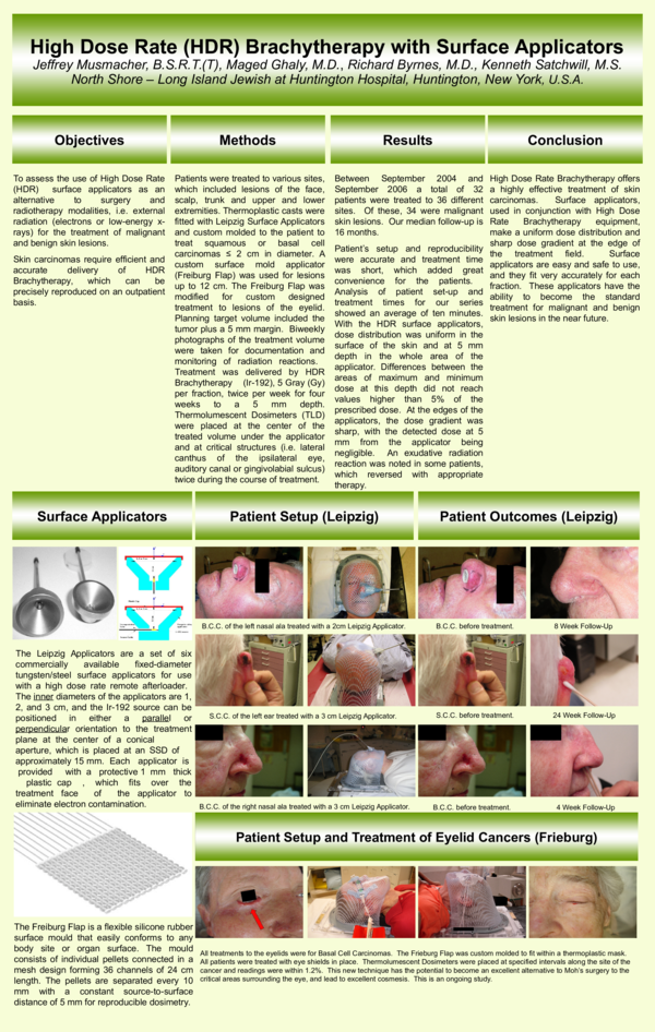 (PPT) HDR BRACHYTHERAPY POSTER ESTRO