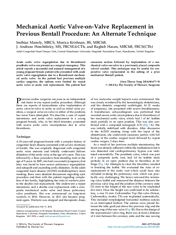(PDF) Mechanical Aortic Valve-on-Valve Replacement in Previous Bentall ...