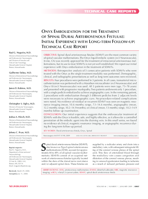 (PDF) Onyx embolization for the treatment of spinal dural arteriovenous ...