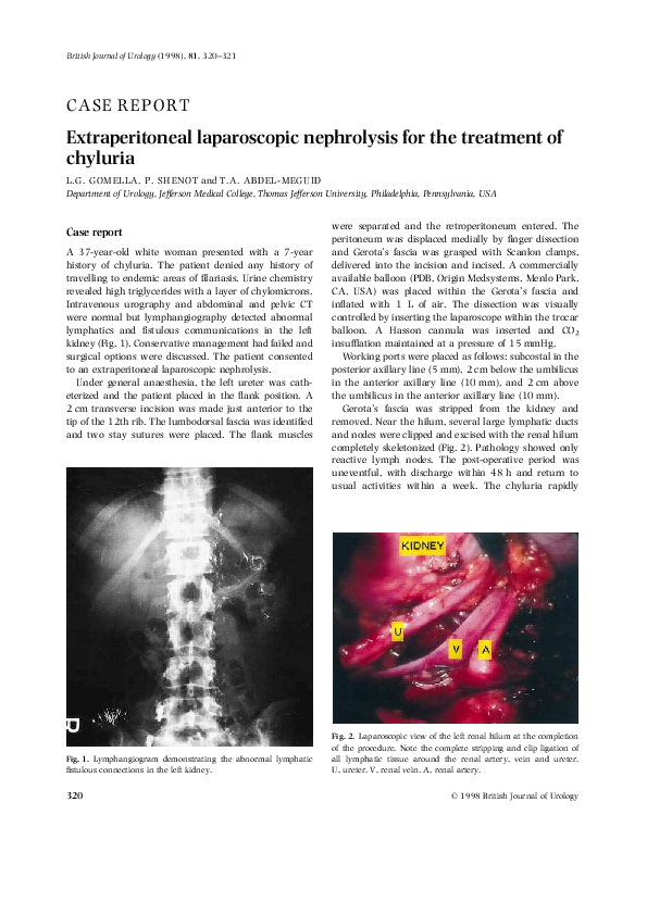 (PDF) Extraperitoneal laparoscopic nephrolysis for the treatment of ...
