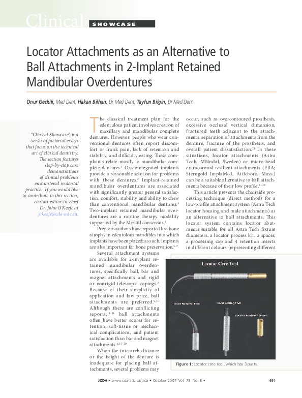 (PDF) Locator Attachments as an Alternative to Ball Attachments in 2 ...