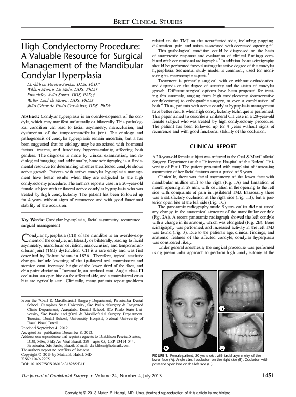 (PDF) High Condylectomy Procedure