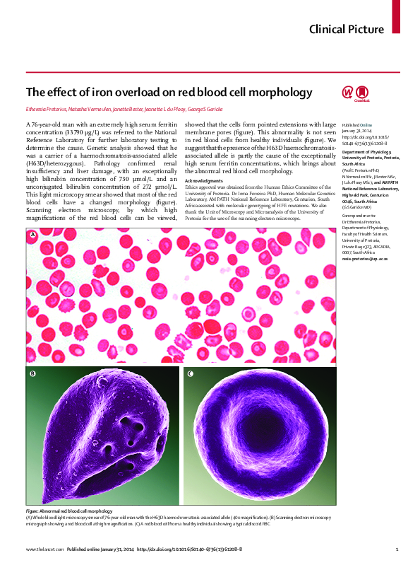 (PDF) The effect of iron overload on red blood cell morphology