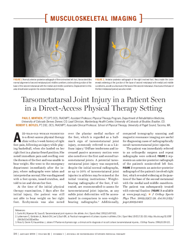 (PDF) Tarsometatarsal Joint Injury in a Patient Seen in a Direct-Access ...