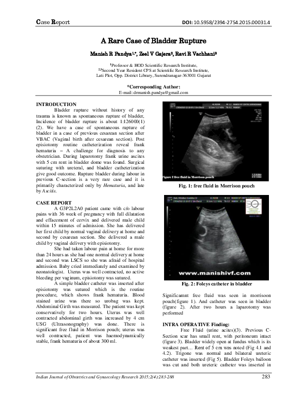 (PDF) A Rare Case of Bladder Rupture