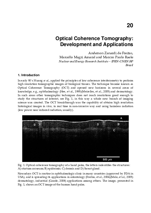 (PDF) Optical Coherence Tomography: Development and Applications