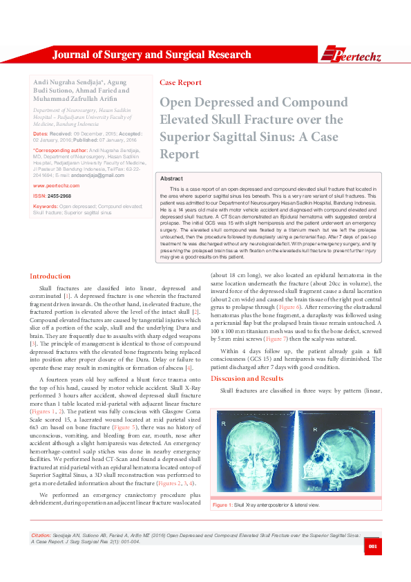 (PDF) Open Depressed and Compound Elevated Skull Fracture over the ...