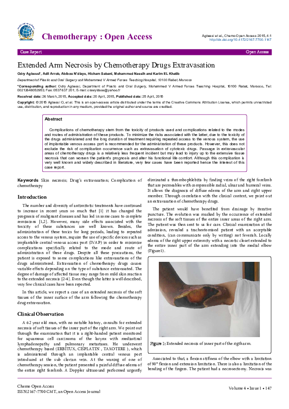 (PDF) Extended Arm Necrosis by Chemotherapy Drugs Extravasation