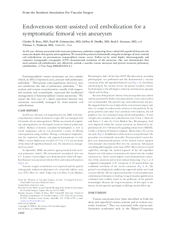 (PDF) Endovenous stent-assisted coil embolization for a symptomatic ...